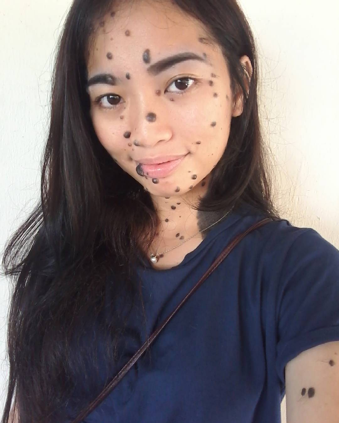 Los lunares en el cuerpo de esta chica no definen su belleza