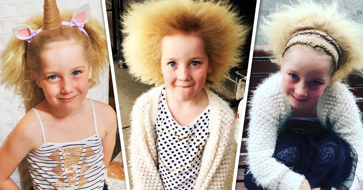 Esta adorable niña tiene el síndrome del cabello impeinable