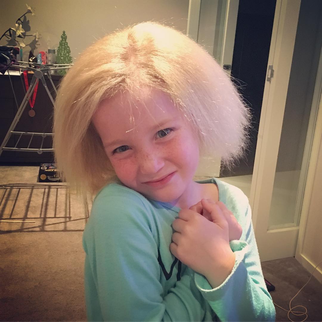 Esta adorable niña tiene el síndrome del cabello impeinable