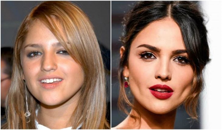 20 Celebridades antes y después de operarse la nariz