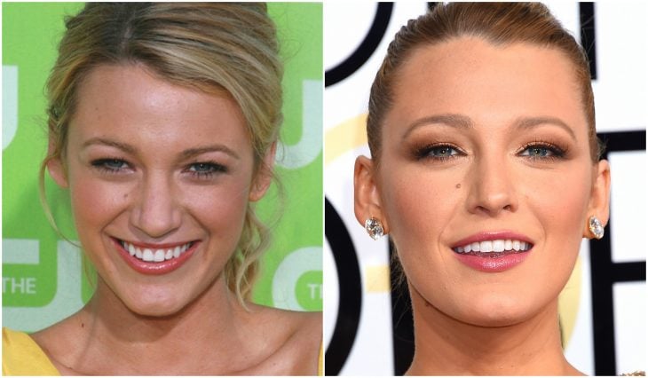 20 Celebridades antes y después de operarse la nariz