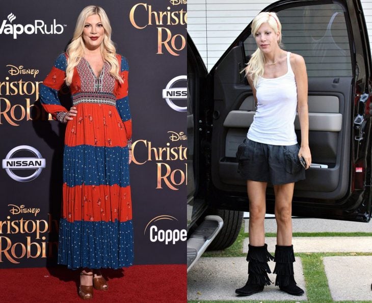 13 Famosas son el ejemplo de que la delgadez es un problema