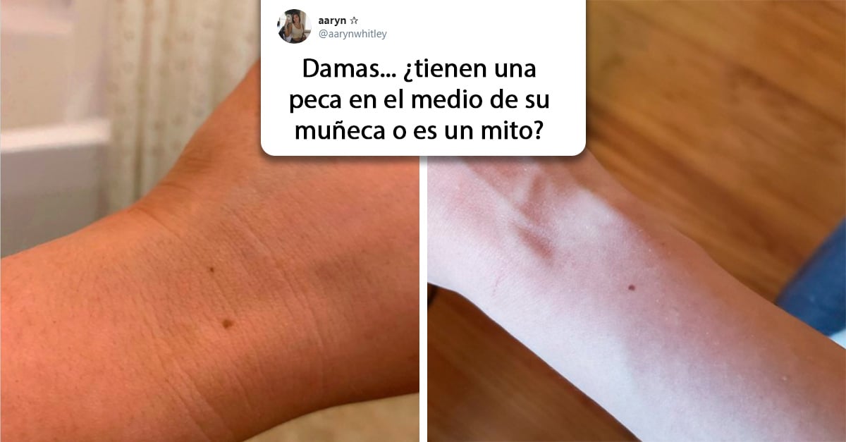 Usuarias de Twitter descubren que tienen un lunar en la mano