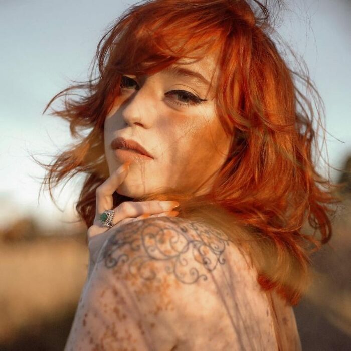 Woman With Vitiligo Overcomes Confidence Issues After Becoming A Model ...