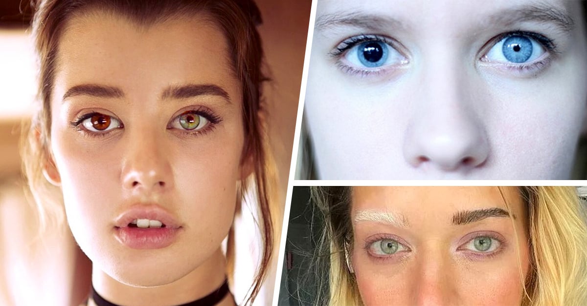 13 Personas con rasgos únicos que te enamorarán de inmediato