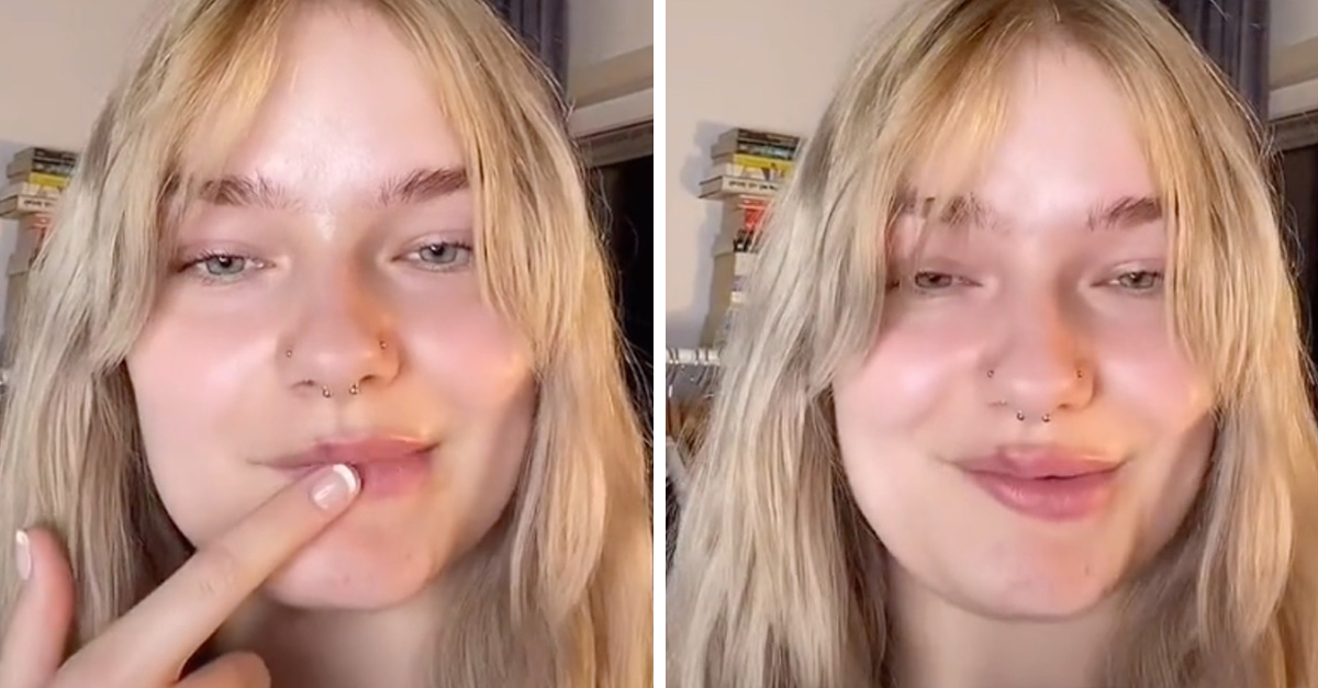 He injected Botox the wrong way and ended up with a mess on his lips ...