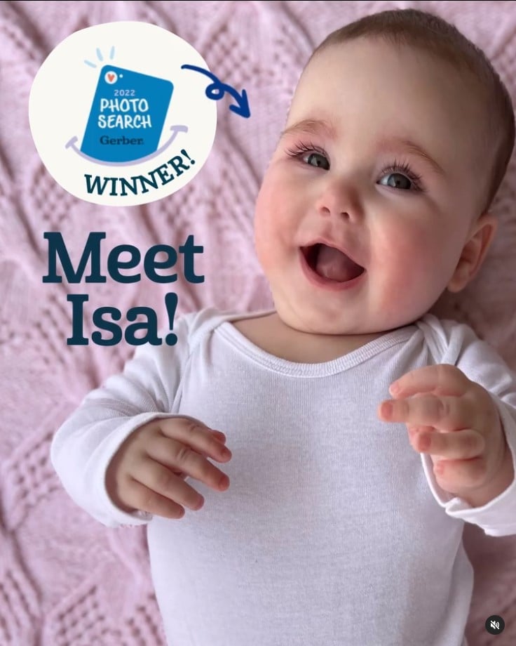 La bebé Gerber 2022 muestra que las imperfecciones son bellas