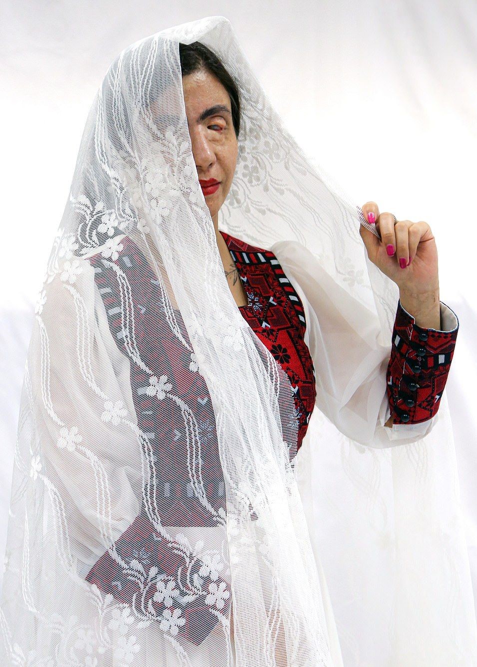 Víctimas de ataques con ácido son elegidas como modelos