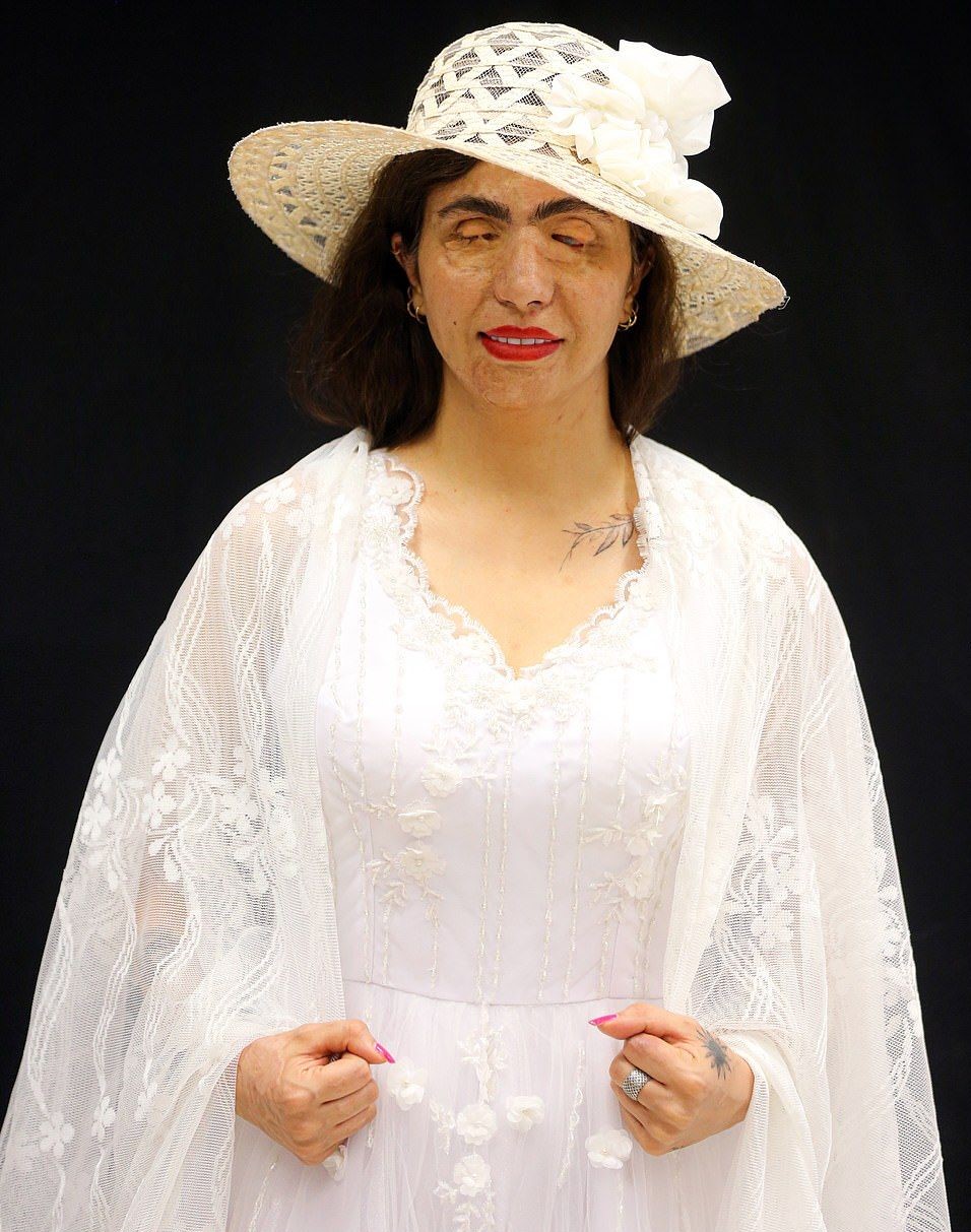 Víctimas de ataques con ácido son elegidas como modelos