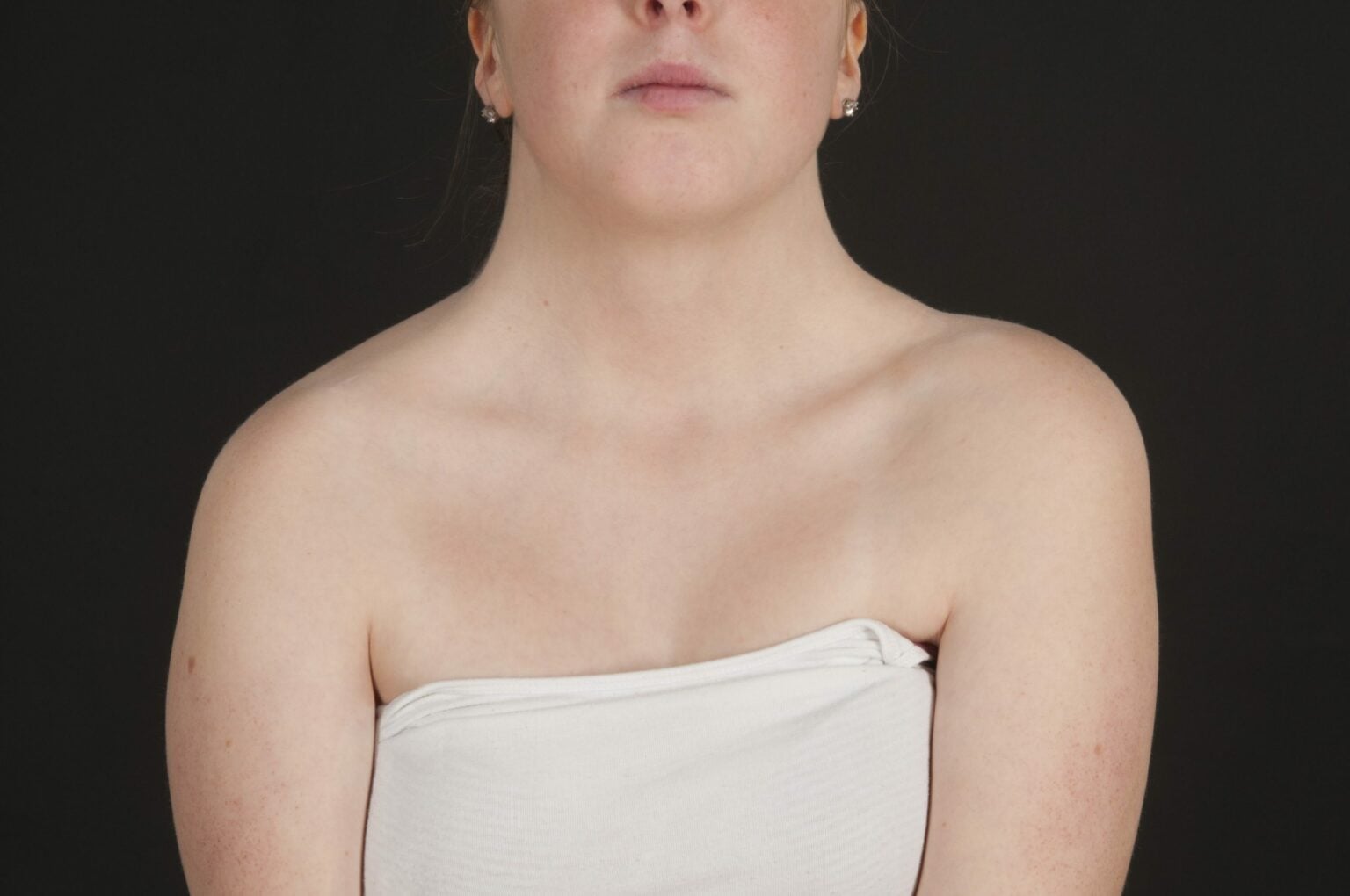 El síndrome de Turner, la enfermedad que solo afecta a mujeres