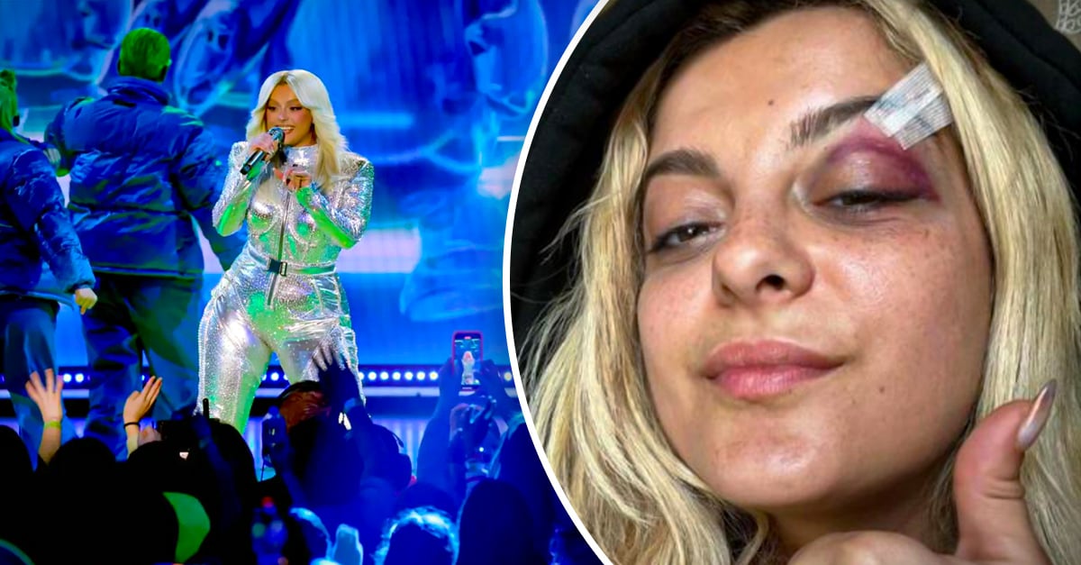Fan hits Bebe Rexha in the face with a cell phone and ends up in the ...